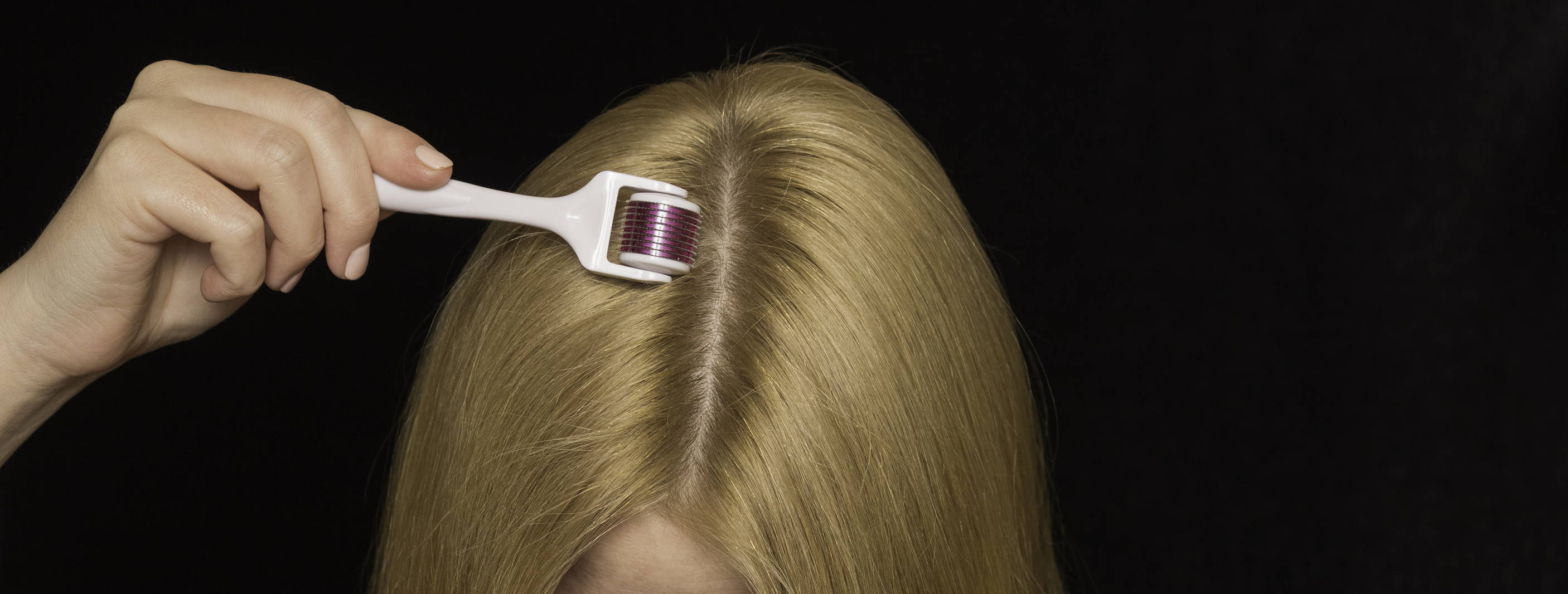 Microneedling for the Treatment of Hair Loss – DS Healthcare Group