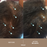 Spectral.DNC-N | Hair Density Serum with Nanoxidil® 5% – DS Healthcare ...