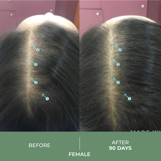 Spectral.CBD | HAIR DENSITY SERUM WITH CBD + Nanoxidil® 5% – DS ...